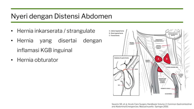 Peritonitis dan Optek Perforasi Gaster.pptx