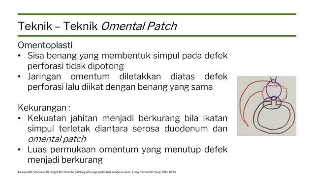 Peritonitis dan Optek Perforasi Gaster.pptx