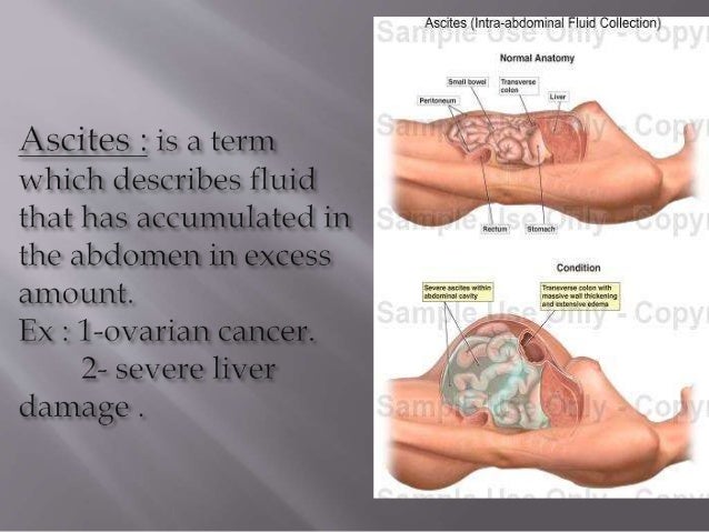 Peritonium (anatomy and physiology and pathology)