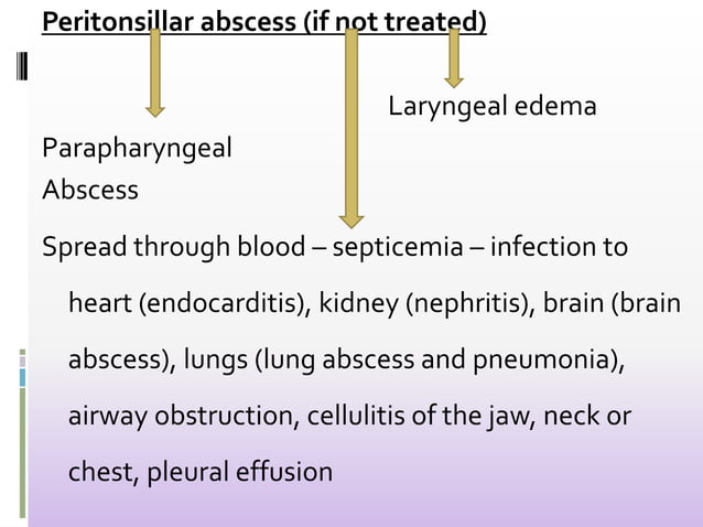 Peritonsilar Abscess a ENT disorder for B.Sc. Nursing students | PPTX ...
