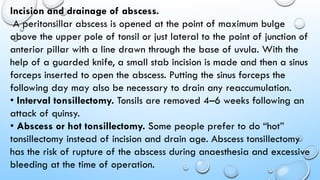 Comprehensive Overview of Peritonsillar Abscess (Quinsy): Anatomy ...