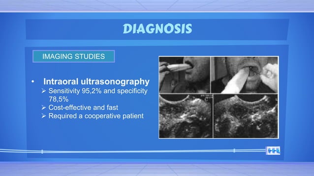 Peritonsillar Abscess (Quinsy) | PPT