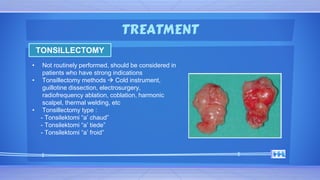 Peritonsillar Abscess (Quinsy) | PPTX