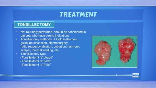 Peritonsillar Abscess (Quinsy) | PPT