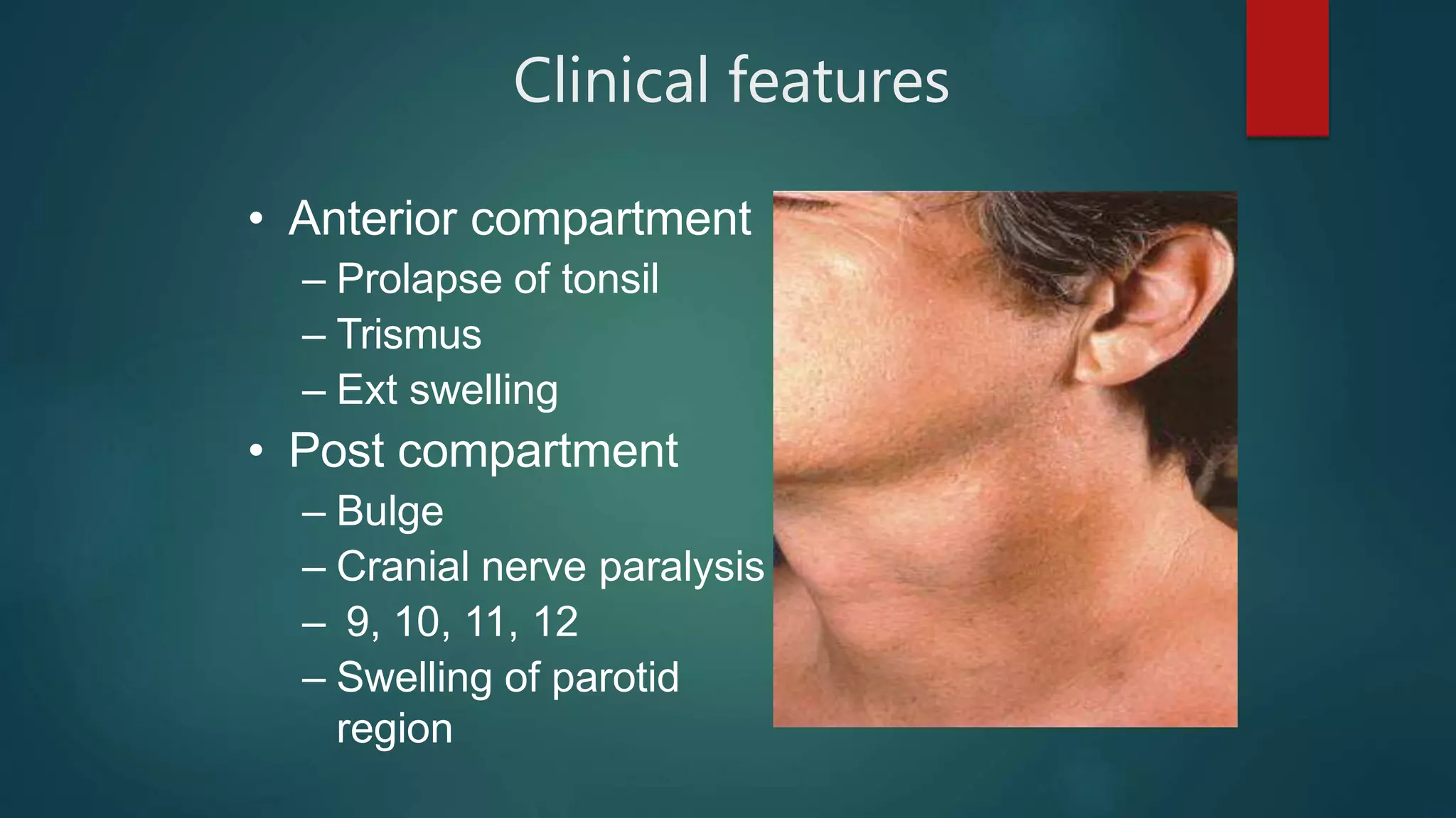 Peritonsillar abscess, parapharyngeal abscess, retropharyngeal abscess ...