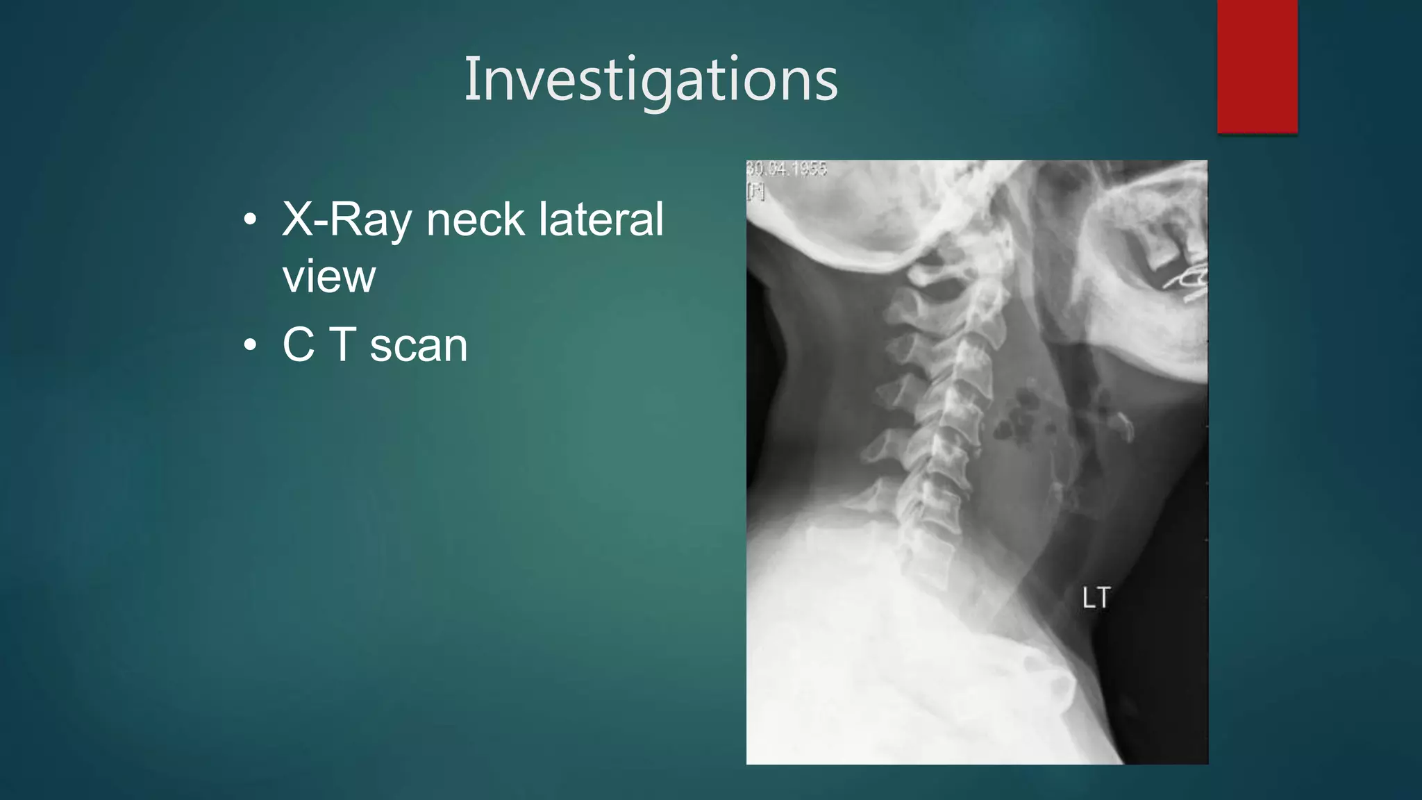 Peritonsillar abscess, parapharyngeal abscess, retropharyngeal abscess ...