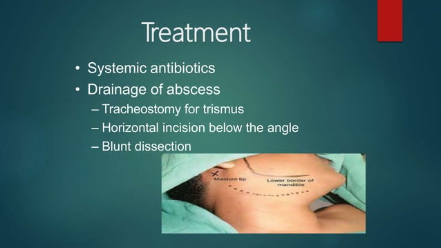 Peritonsillar abscess, parapharyngeal abscess, retropharyngeal abscess ...