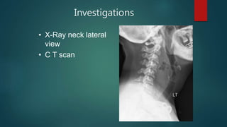 Peritonsillar Abscess X Ray