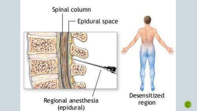 Periudha intra operatore/Anestezia | PPTX