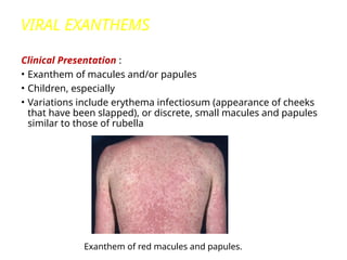 Perivascular dermatitis in human skin.pptx