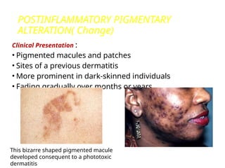 Perivascular dermatitis in human skin.pptx