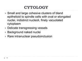 Perivascular epithelioid cell neoplasm (PEComas) | PPTX