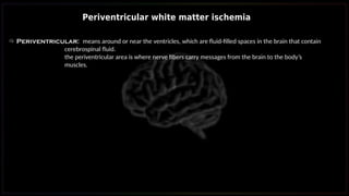periventricular white watter disease. ppt.pptx