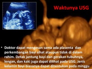 Perkembangan pranatal | PPT