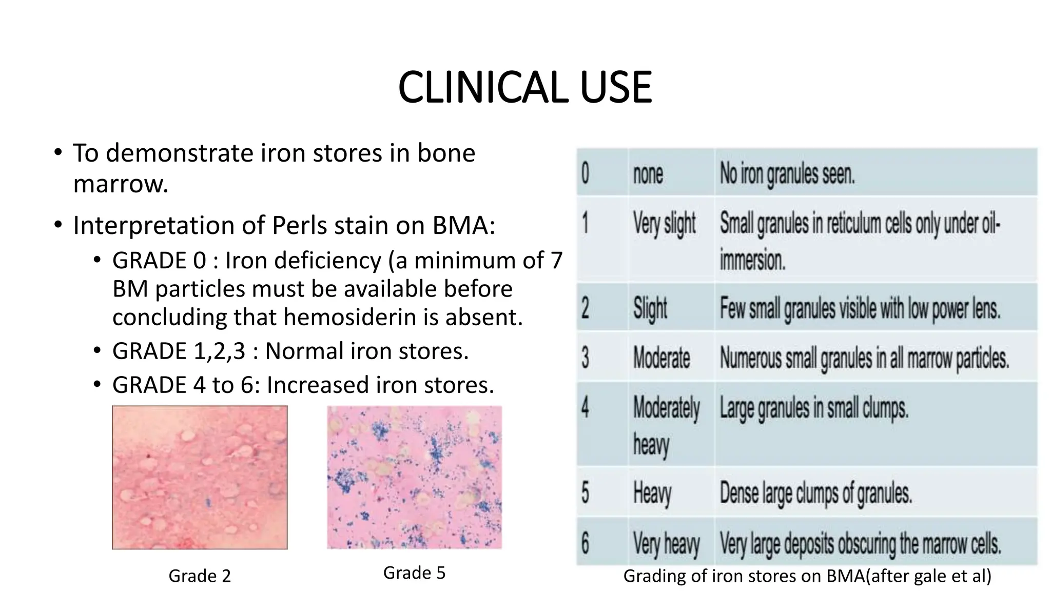 perls prusian blue stain in hematology.pptx