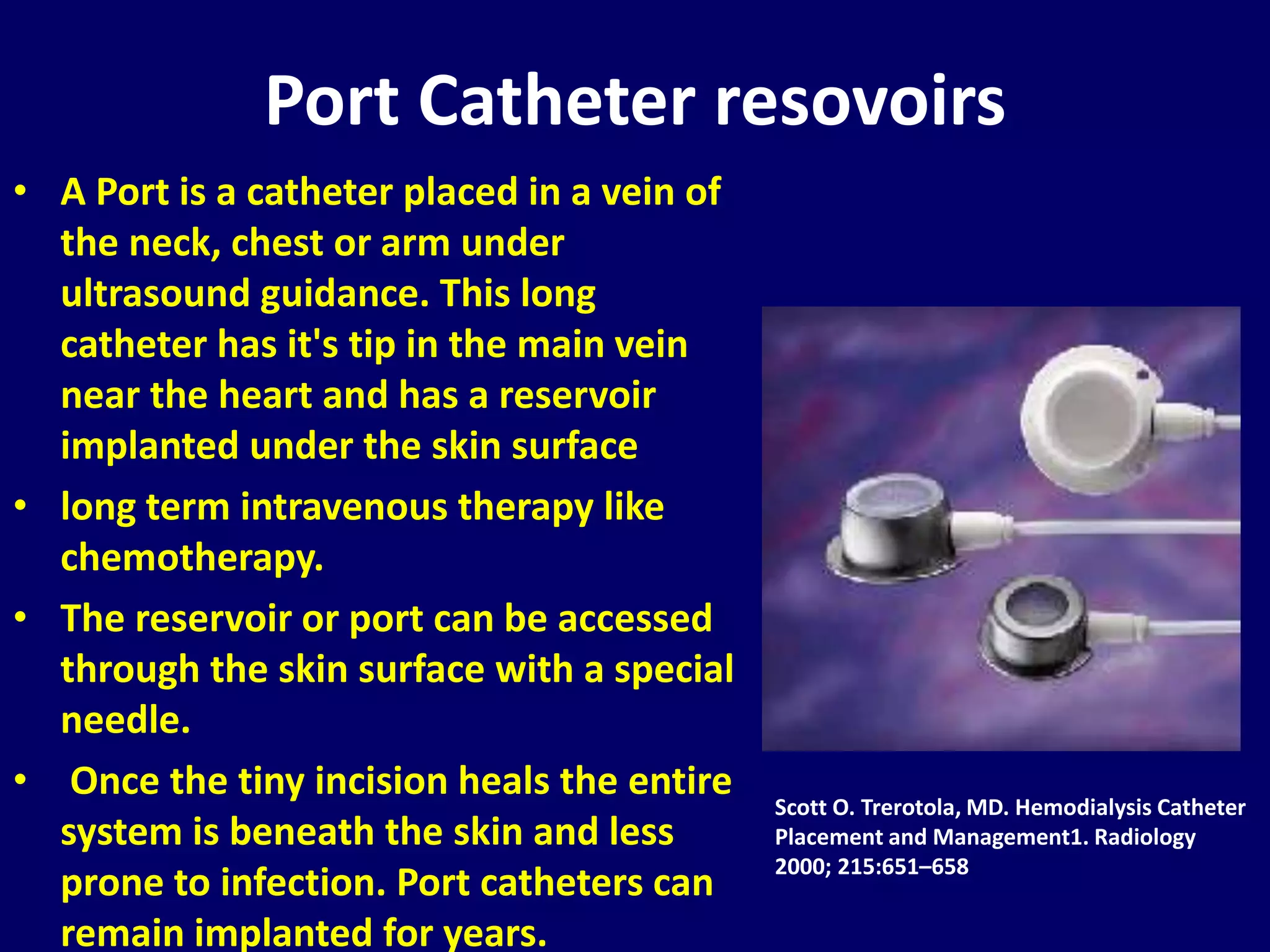 PermacathPlacement under US guaidance DR. muhammad Bin Zulfiqar | PPTX
