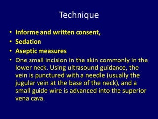 PermacathPlacement under US guaidance DR. muhammad Bin Zulfiqar | PPTX