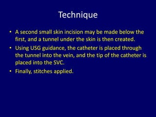 PermacathPlacement under US guaidance DR. muhammad Bin Zulfiqar | PPTX