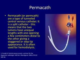 PermacathPlacement under US guaidance DR. muhammad Bin Zulfiqar | PPT