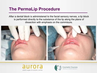 Perma lip overview presentation | PPT | Cosmetic Medical Services ...