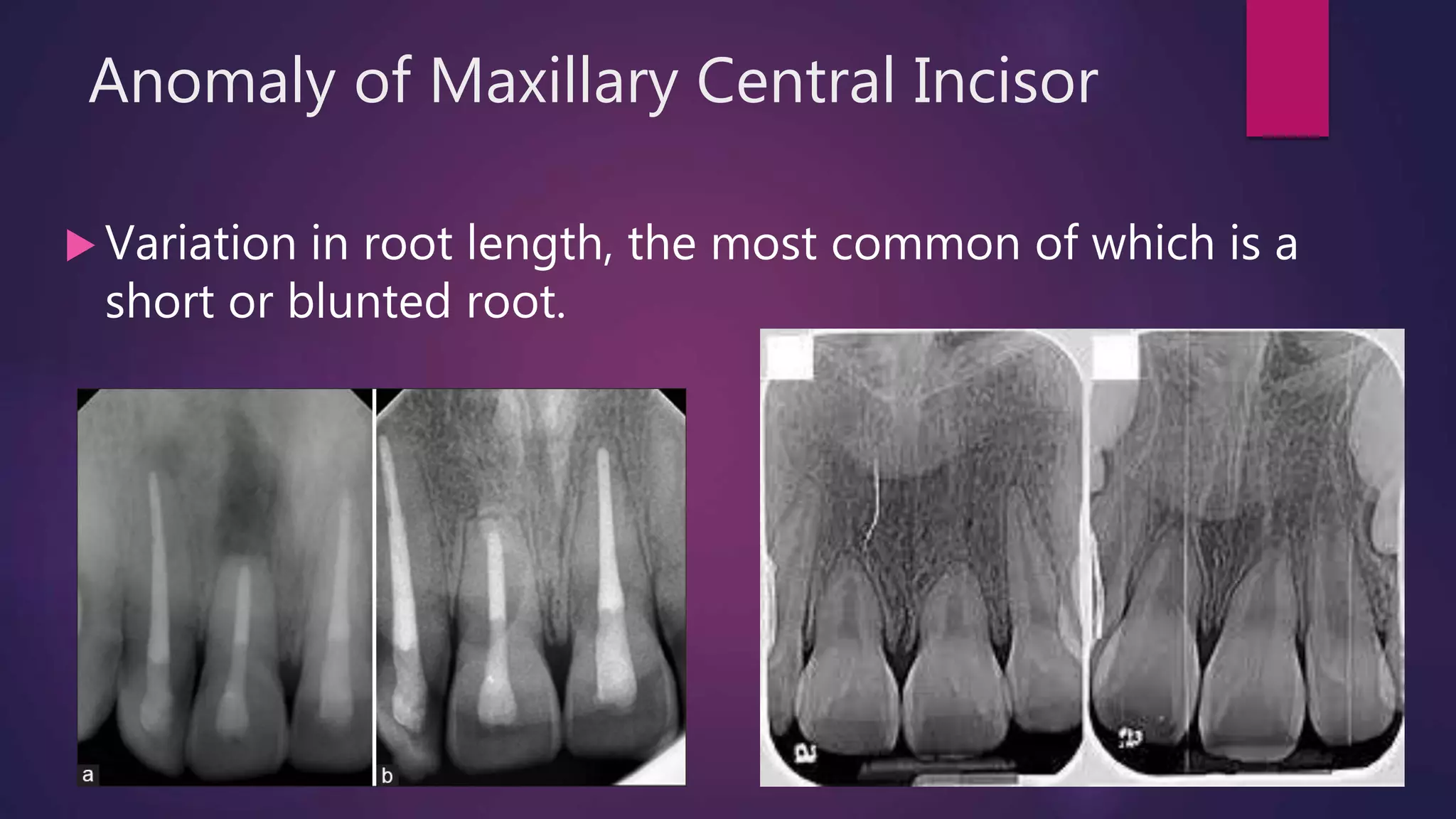 Permanent anterior teeth | PPTX