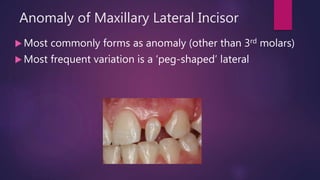 Permanent anterior teeth | PPTX