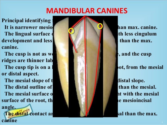 Permanent canines