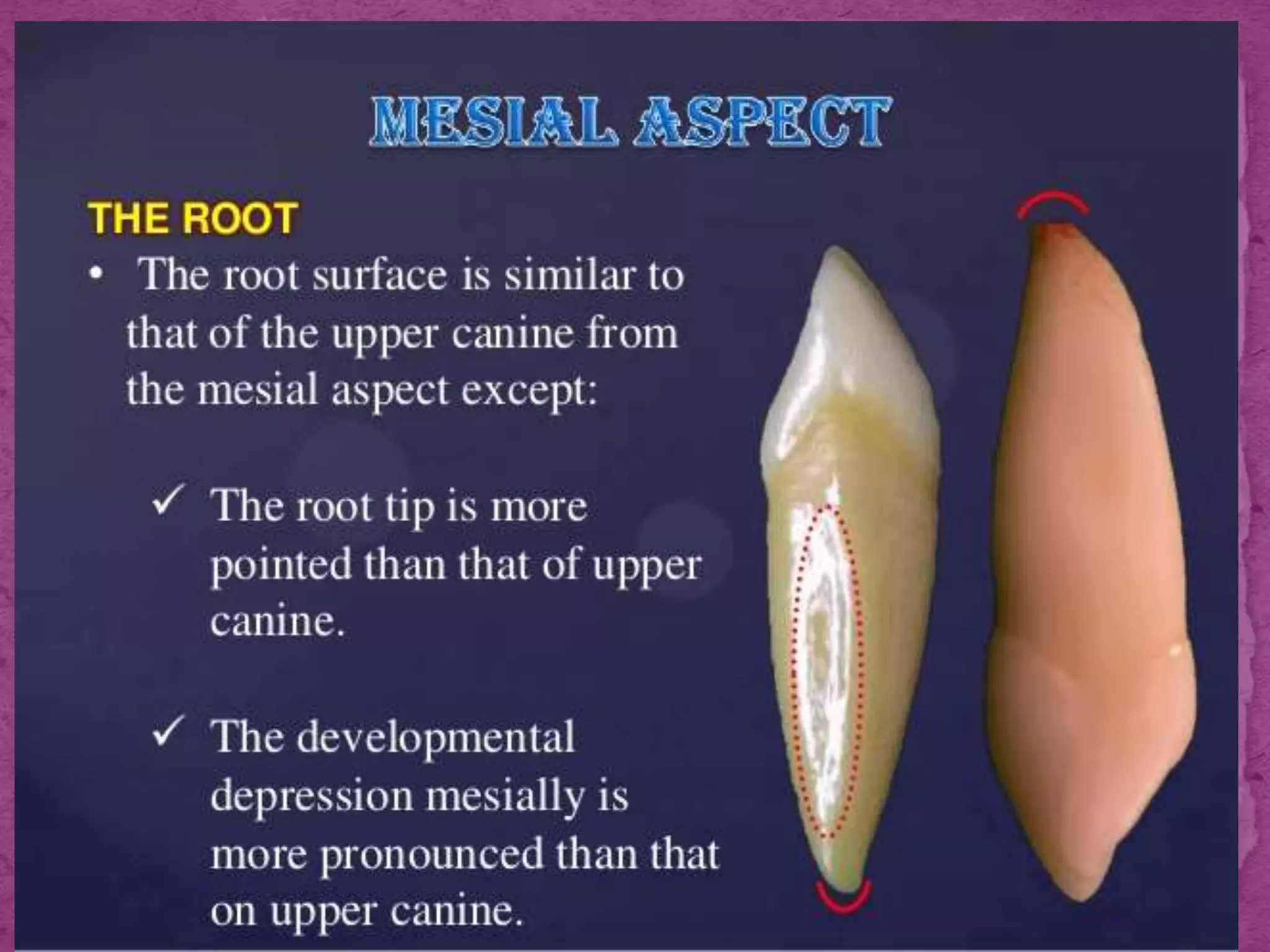 Permanent Mandibular Canine | PPTX