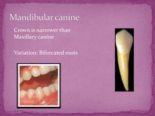 Mandibular Canine
