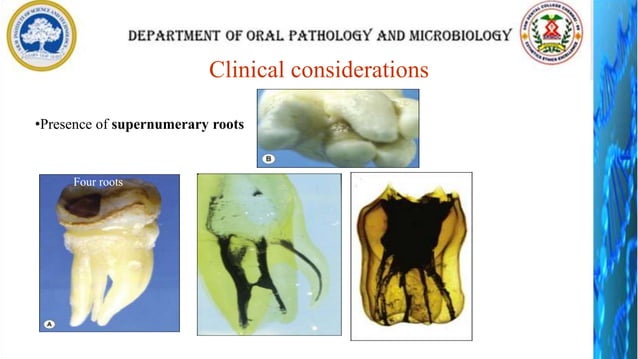 Permanent mandibular first molar | PPTX