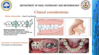 Permanent mandibular first molar | PPTX