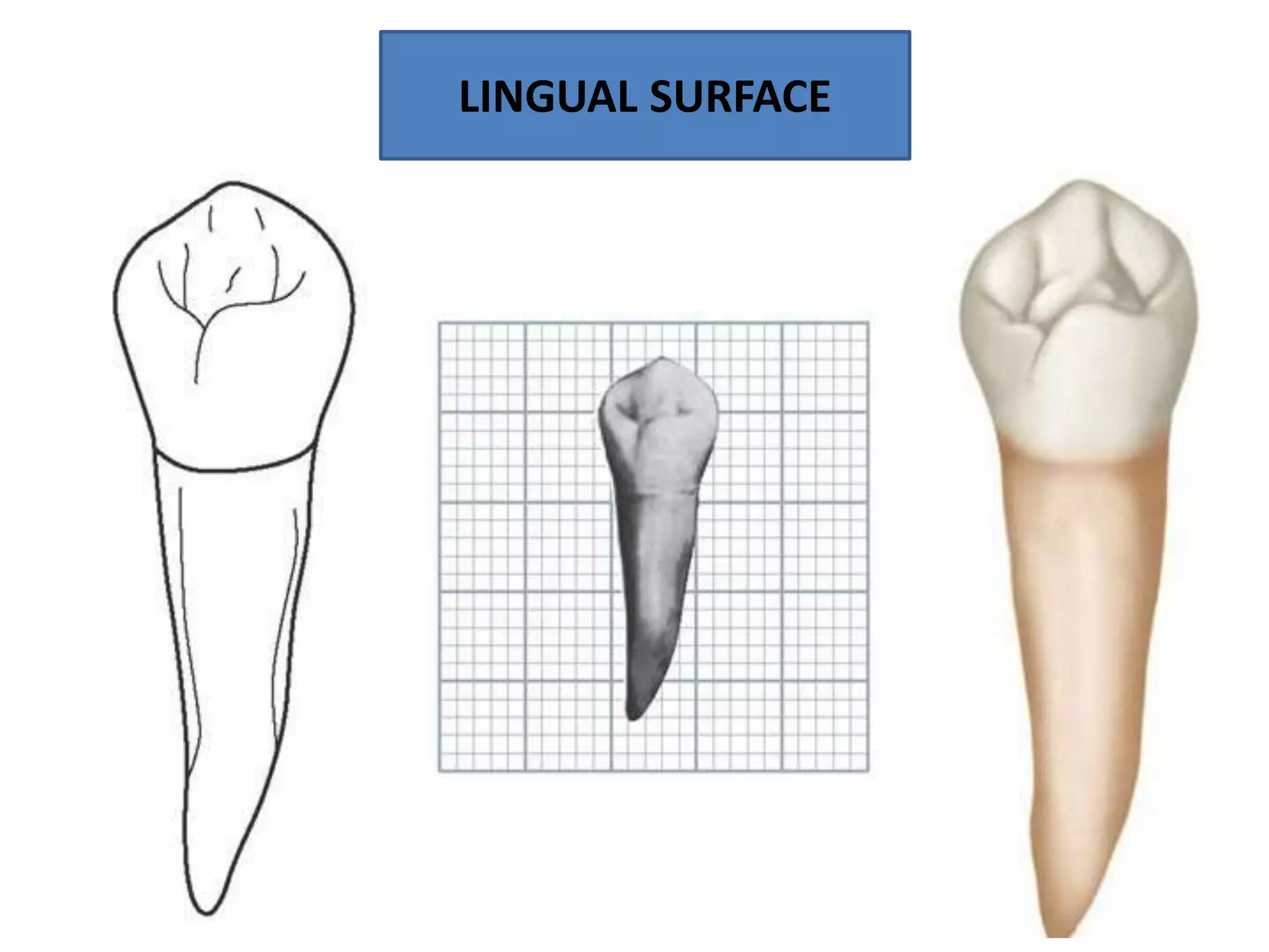 Permanent Mandibular First Premolar Pptx