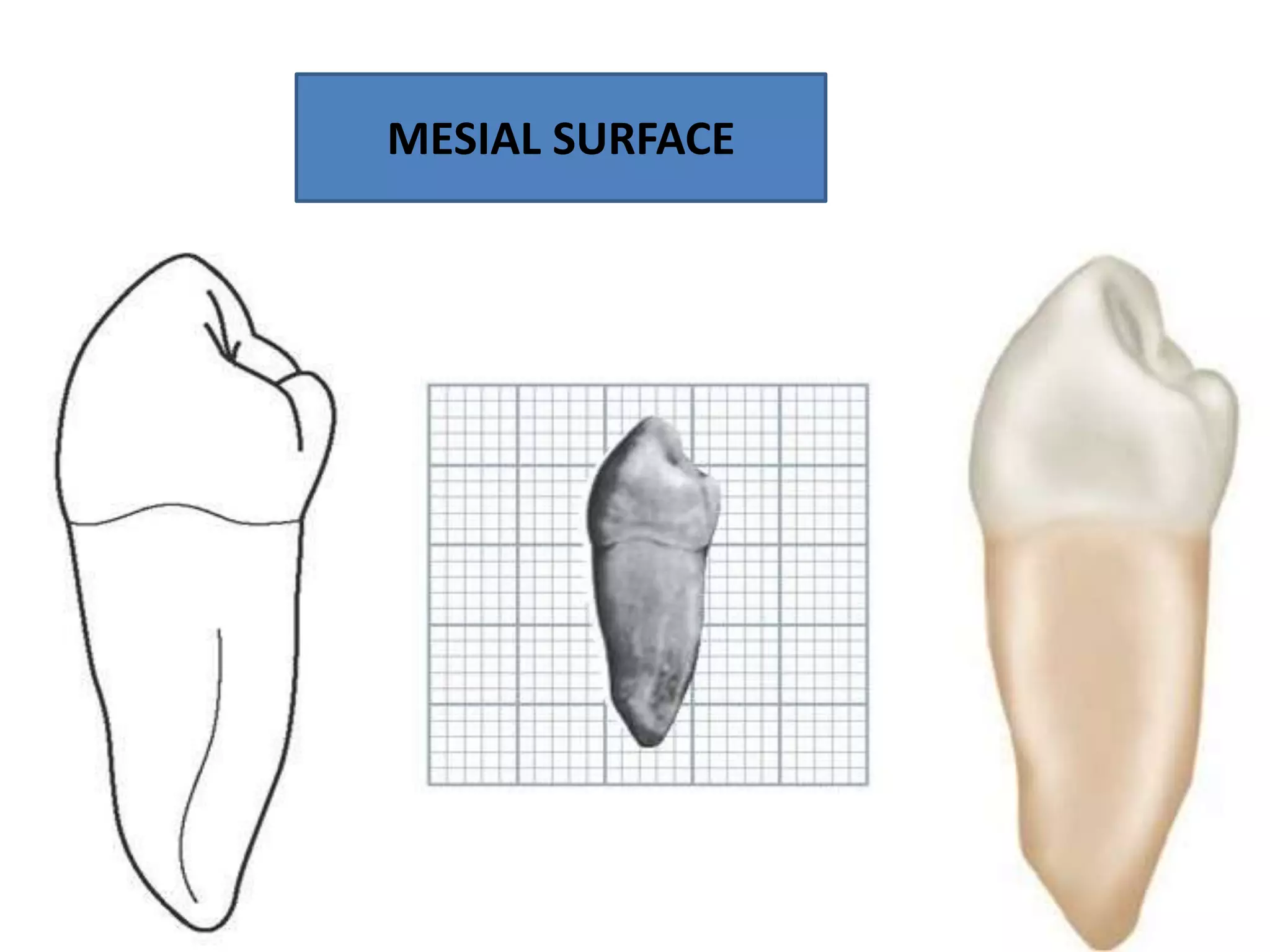 Permanent mandibular first premolar | PPTX