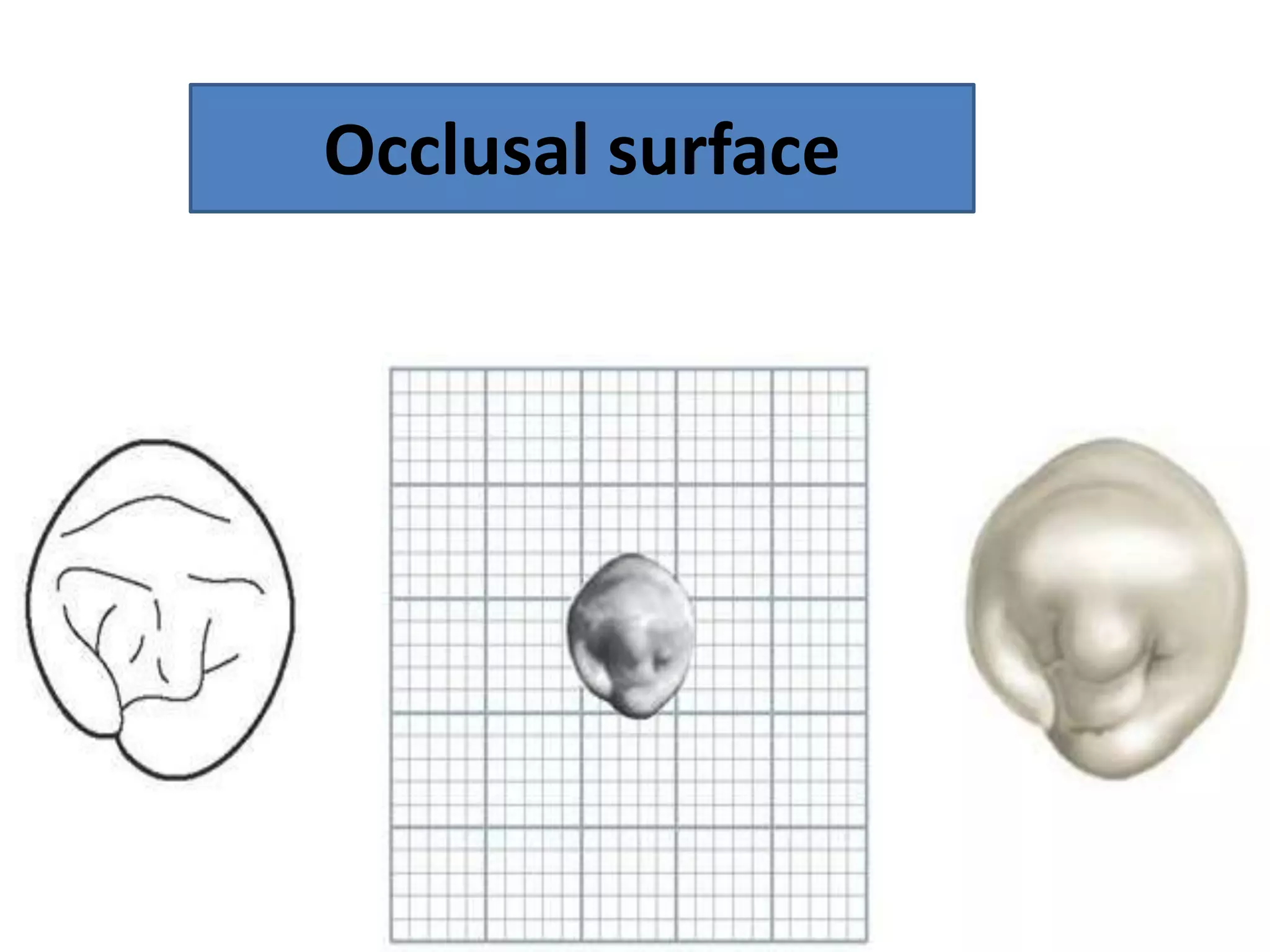 Permanent Mandibular First Premolar Pptx