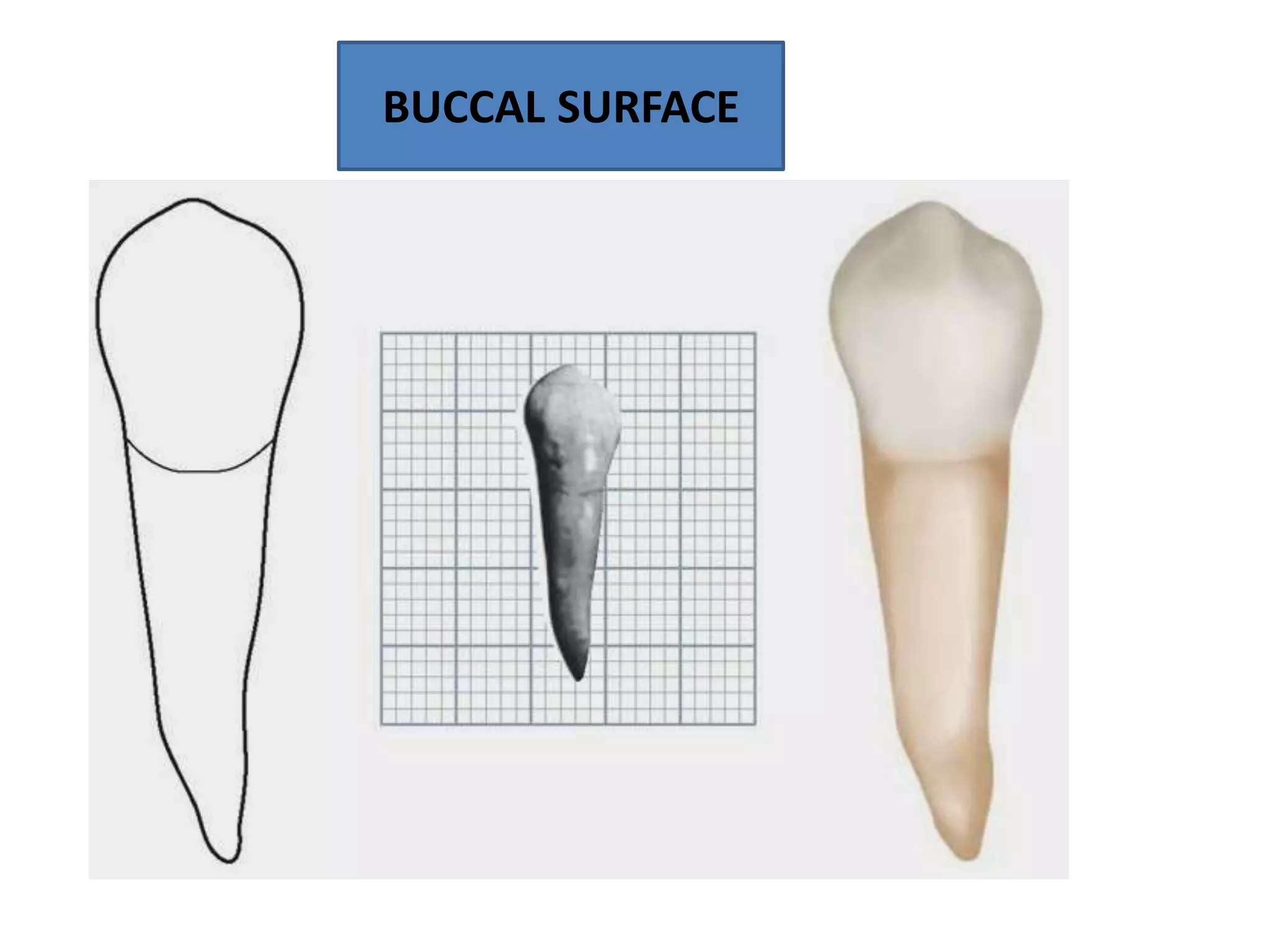 Permanent Mandibular First Premolar Pptx