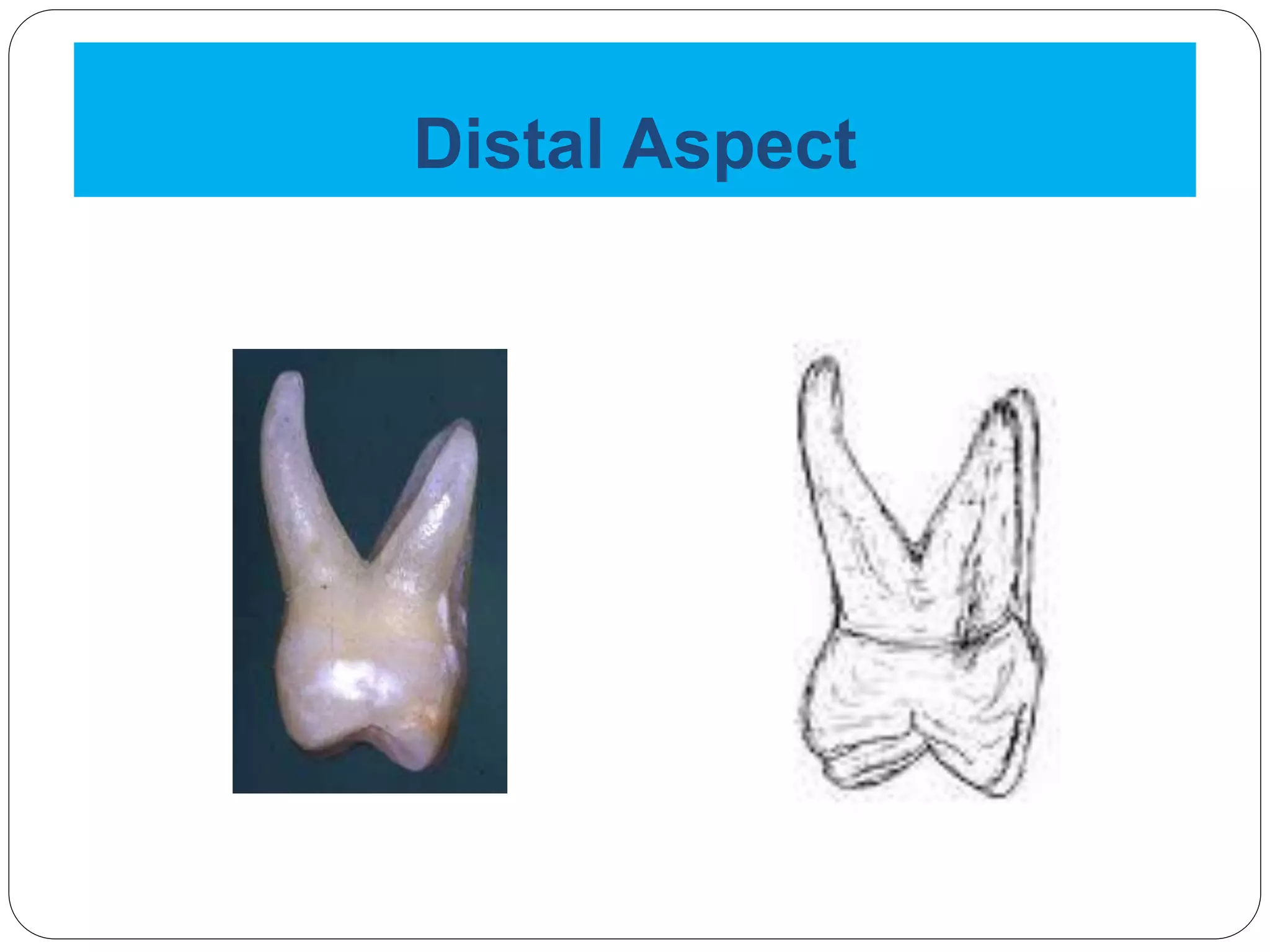 Permanent maxillary first molar | PPT | Dental Health | Diseases and ...