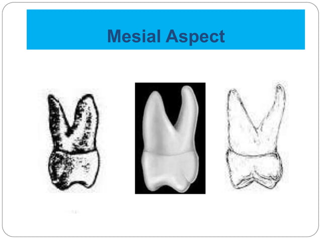 Permanent maxillary first molar | PPT | Dental Health | Diseases and ...