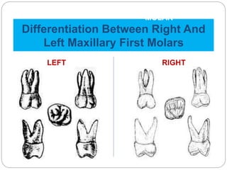Permanent maxillary first molar | PPT