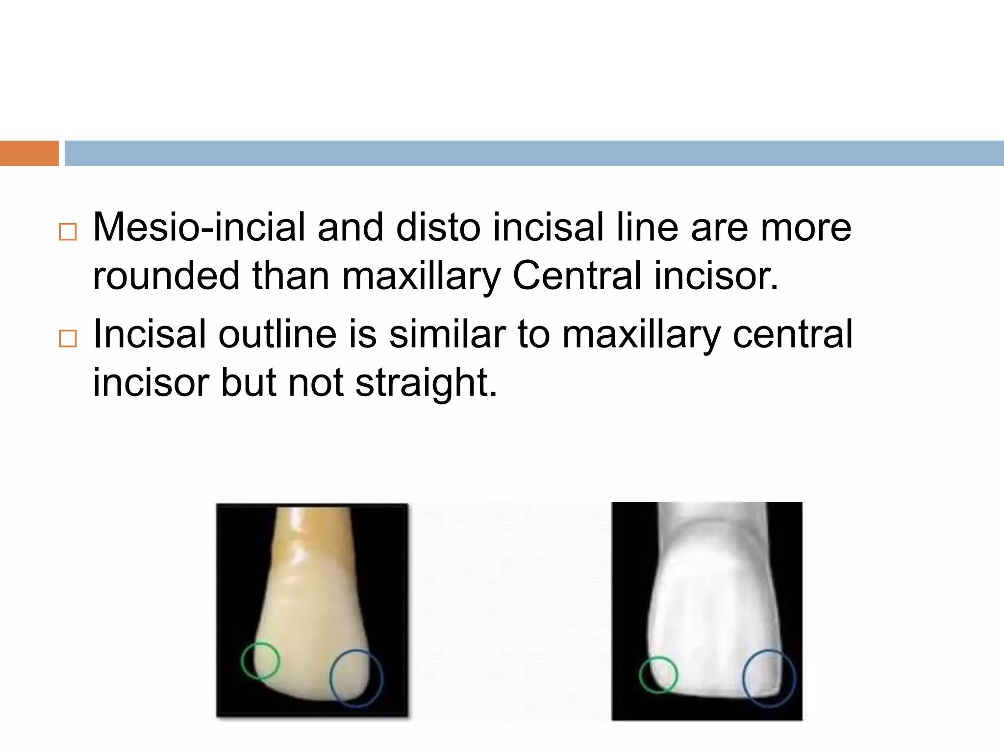 Permanent maxillary lateral incisor | PPTX | Dental Health | Diseases ...