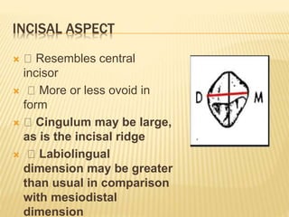 Permanent Maxillary Lateral Incisor | PPTX