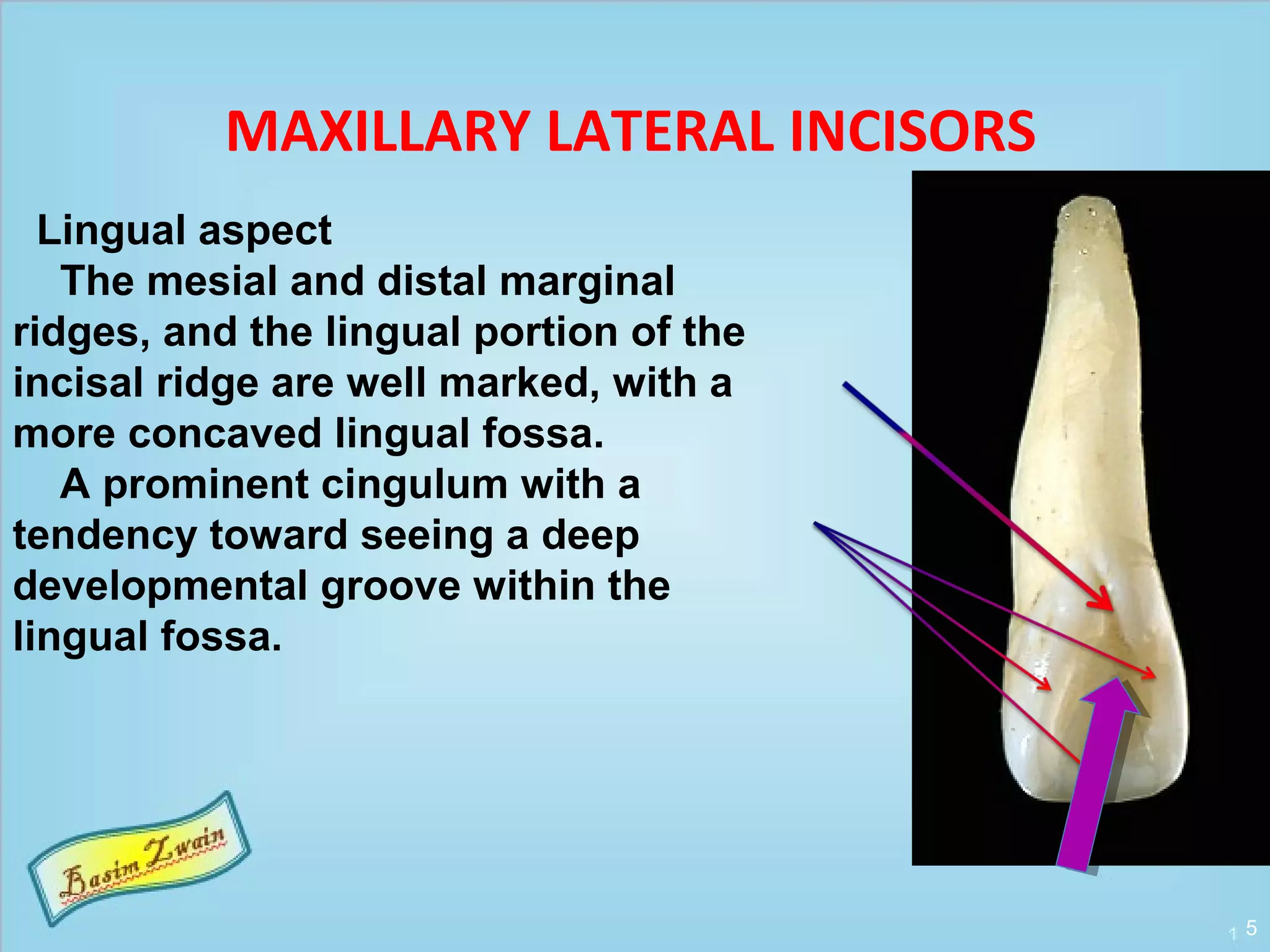 Permanent maxillary lateral incisors | PPT