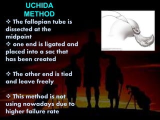 Permanent methods of family planning ppt.-BIJU | PPT