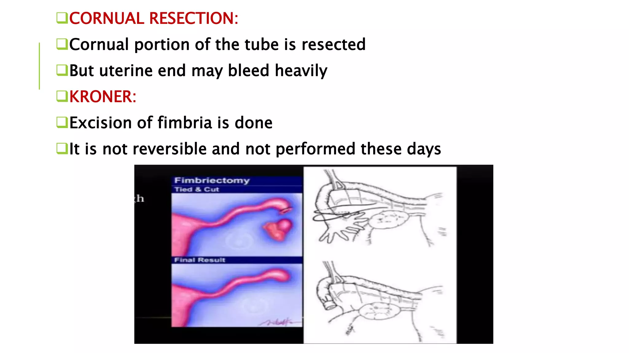 Permanent sterilisation.pptx
