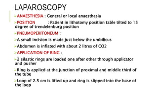 Permanent sterilisation.pptx