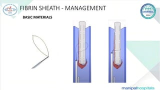 PERMCATH EXCHANGE AND FIBRIN SHEATH STRIPPING.pptx