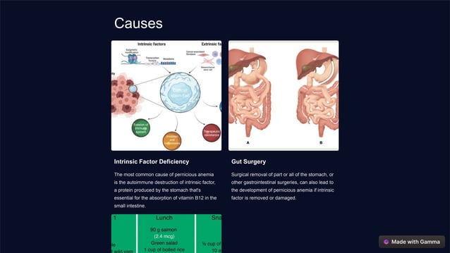 Pernicious-Anemia-An-Overview (1).pptx