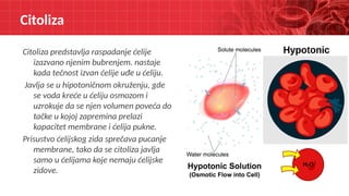 🩸 | Perniciozna anemija i hemolitičke anemije | PPTX
