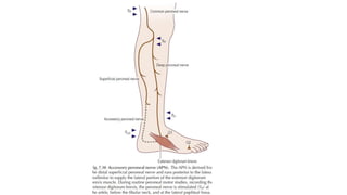 Peroneal neuropathy. sciatic neuropathyy | PPTX