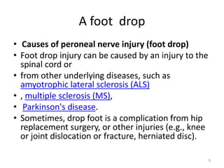 Peroneal nerve injury foot drop treatment | PPTX