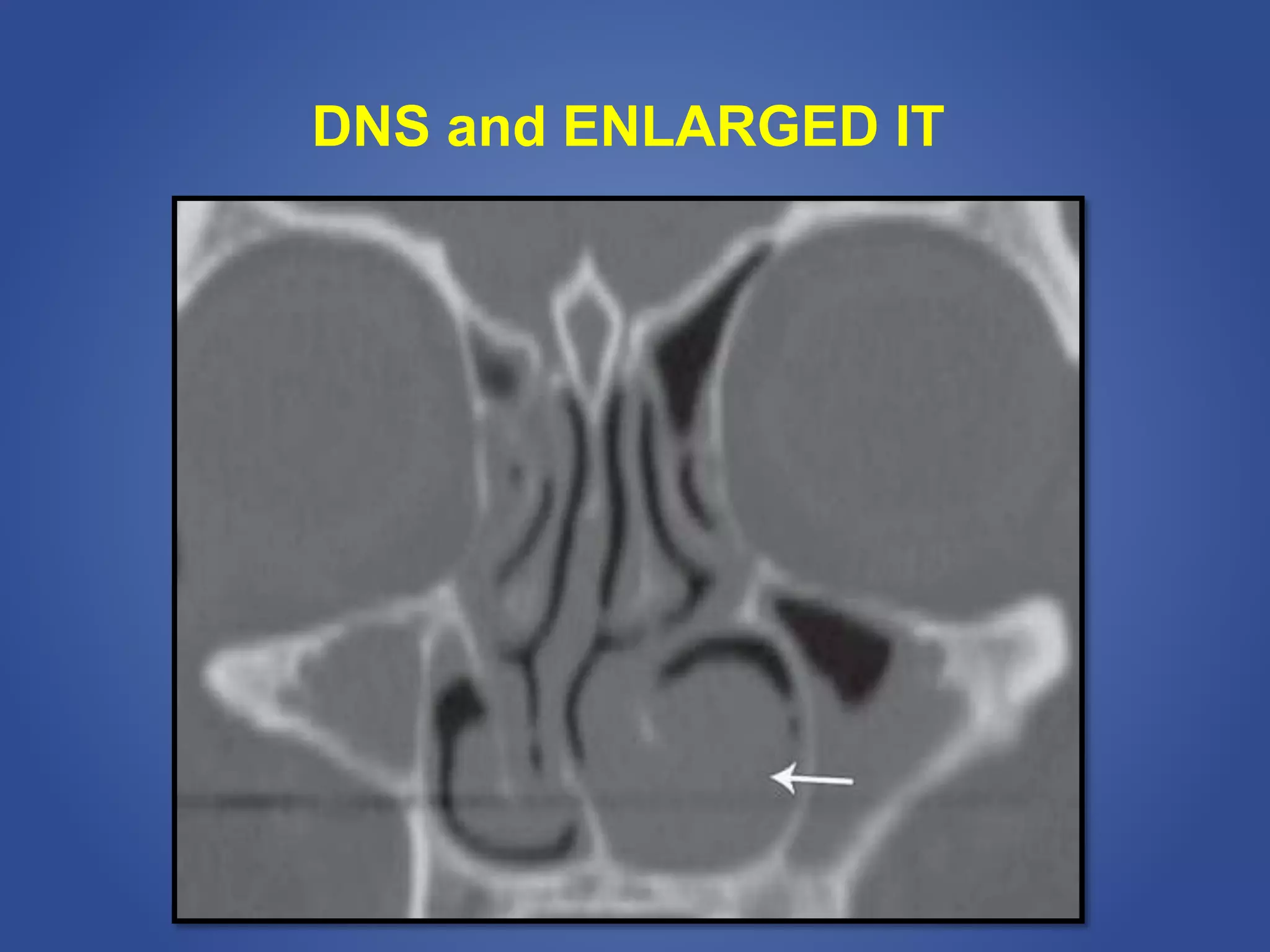 Peroperative PNS CT - A 10-steps evaluation | PPTX